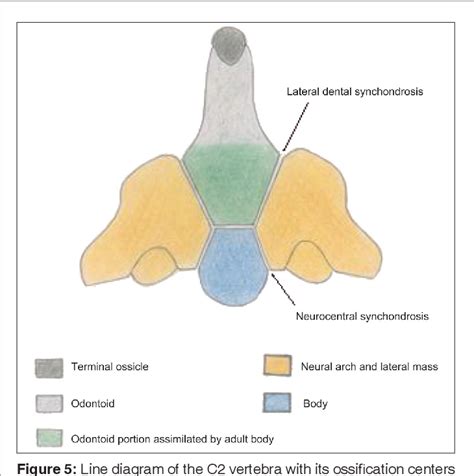 Odontoid Vertebra