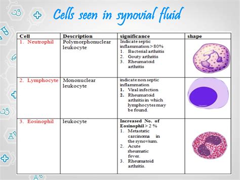 Ppt Synovial Fluid Analysis Powerpoint Presentation Free Download Id 9706708