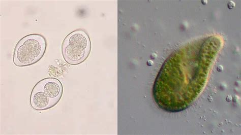 Classification Of Protozoa Biology Notes Online