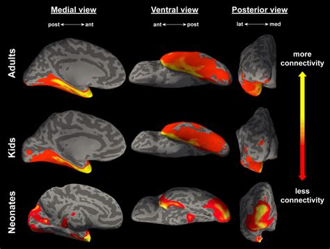 Connectivity Between The Lateral Subnucleus And The Entire Download Scientific Diagram