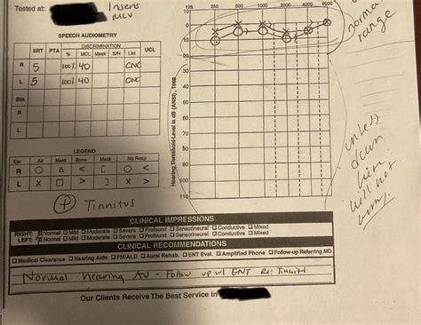 Is My Audiogram Normal For Being 26 Hearingloss