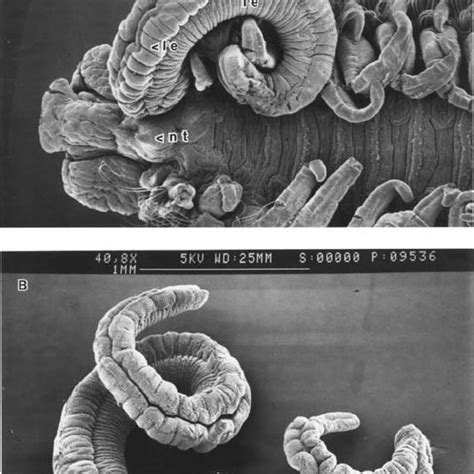 Scanning Electron Micrographs Of Spio Setosa A Dorsal View Of The Download Scientific Diagram