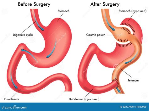 Blocksi Bypass At Jaime Cardenas Blog