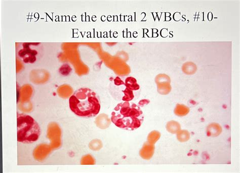 Solved 9 Name The Central 2 ﻿wbcs ﻿ 10evaluate The Rbcs