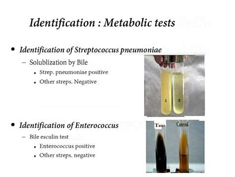 Streptococcus Misc Streptococcus Pneumoniae Microbiology Ascp