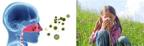 Ургамлын тоосны Арьсны Өвчин Судлалын Үндэсний төв