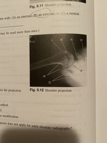 Chap X Rays Flashcards Quizlet