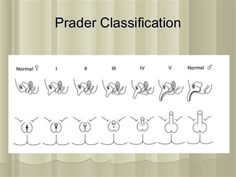 Feminizing Genitoplasty In Cah Patients