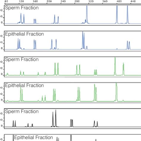 Analysis Of DNA Purified From A 4 Year Old Vaginal Swab Containing Download Scientific Diagram