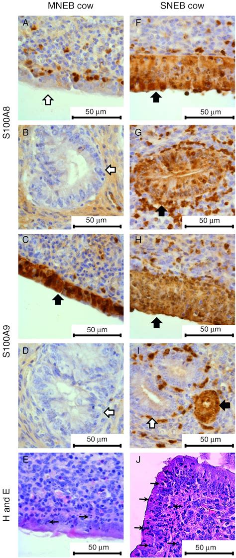 Photomicrographs Of Post Partum Bovine Endometrium To Compare A