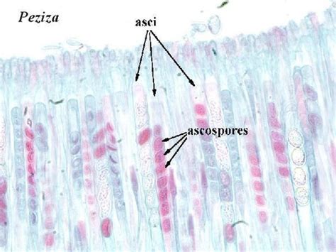 Peziza Under Microscope Labeled