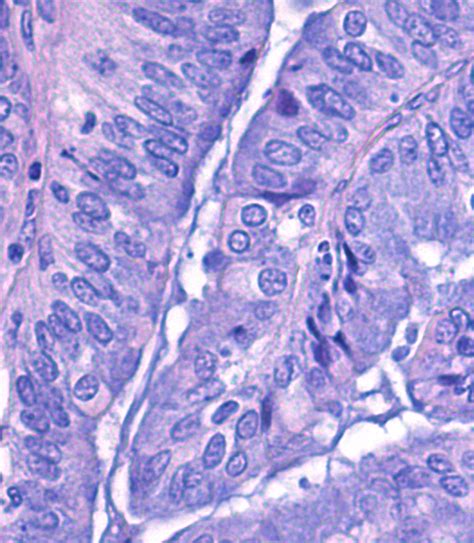 Nuclear Analysis Image Analysis Image Sc Forum