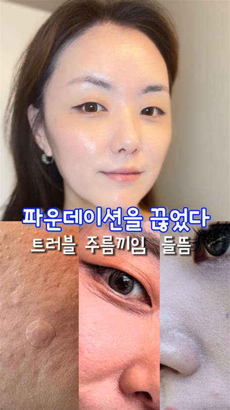 사실 별거아닌 스킨케어인데 제가 하고나서 스스로 더 놀랜답니다🤣 저는 20대부터 트러블을 달고 살았어서 항상 트러블을 걱정하며 살았는데 40대가 넘고보니 기미 잡티 흔적