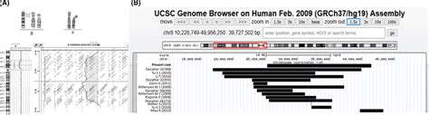 A Partial Karyotypes And Array‐cgh Profile Showing Deletion