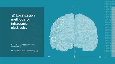 3d Localization Methods For Intracranial Electrodes Ppt