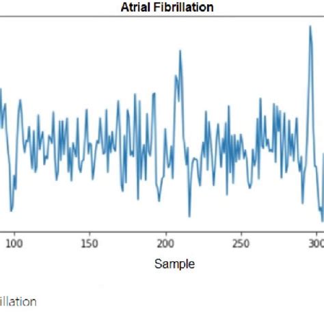 neural network output by console download scientific diagram
