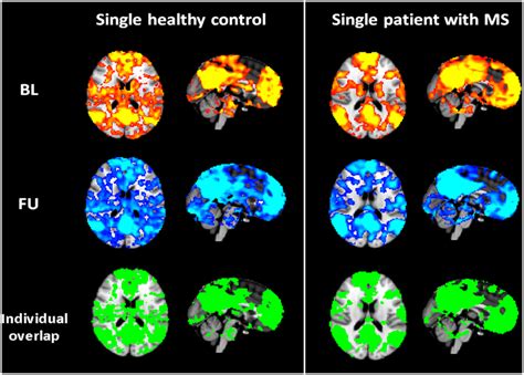 Representative Overlapping Maps Representative Connectivity Maps For