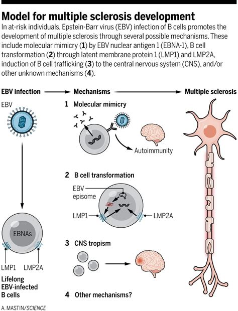 Epstein Barr Virus And Multiple Sclerosis Artofit