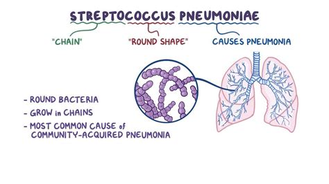 Ppt Streptococcus Pneumoniae Pneumococcus Powerpoint Presentation The Best Porn Website