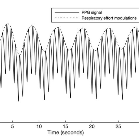 Example Segment Of Ppg Signal With The Envelope Reflecting Respiratory