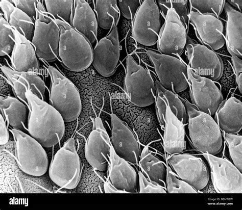 This Scanning Electron Micrograph Sem Depicted Mucosal Surface Small Intestine Gerbil Infested