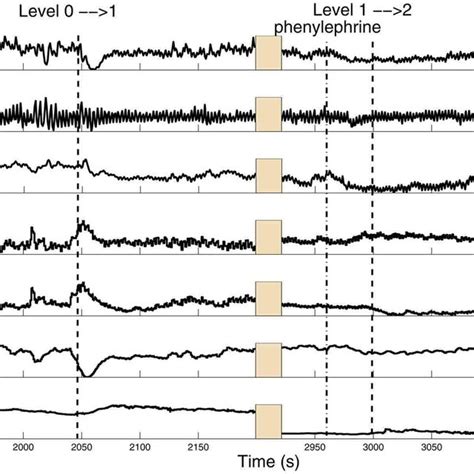 A Simplified Diagram Of The Cardiovascular Closed Loop Model The