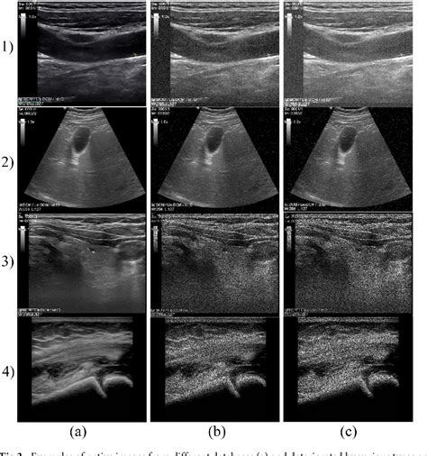 Figure 3 From Comparative Analysis Of Wavelet Transform Filtering Systems For Noise Reduction In
