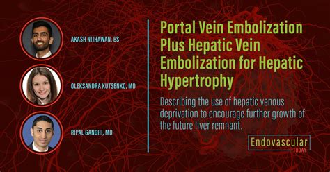 Portal Vein Embolization Plus Hepatic Vein Embolization For Hepatic Hypertrophy Endovascular Today