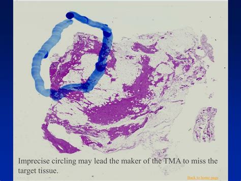 ppt requirements for good tissue microarray tma results powerpoint