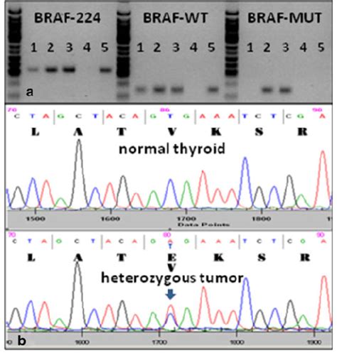 Braf Mutation Analysis By Mutant Allele Specific Pcr Amplification And Download Scientific Braf Mutation Analysis By Mutant Allele Specific Pcr Amplification And Download Scientific