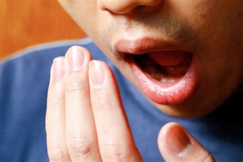 Mundgeruch 14 Ursachen And 8 Tipps Selbsttests Gesundfitde