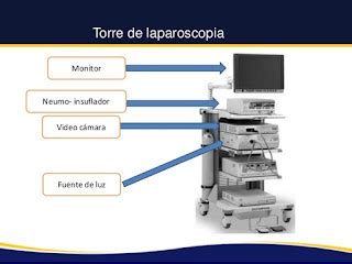 Laparoscopia