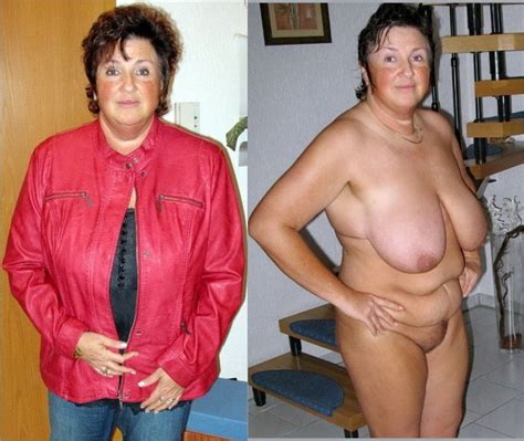 Before After Dressed Undressed 13 92 Porn Pic Eporner