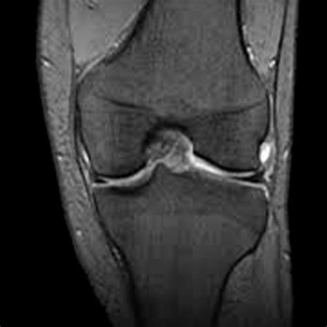 Test Rm Rodilla Diagnóstico Especializado Por Imagen