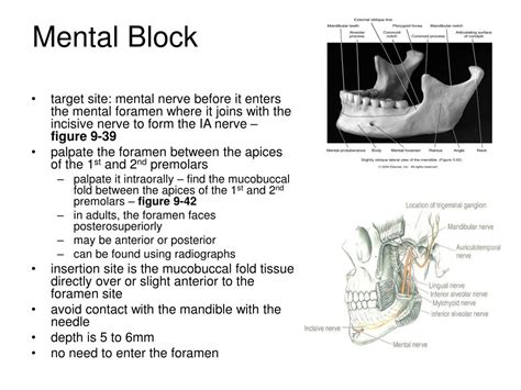 Dental Anesthesia Mental Nerve Block At Henry Briggs Blog