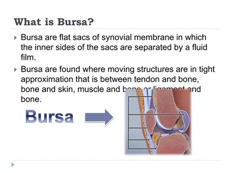 Bursitis Pptx