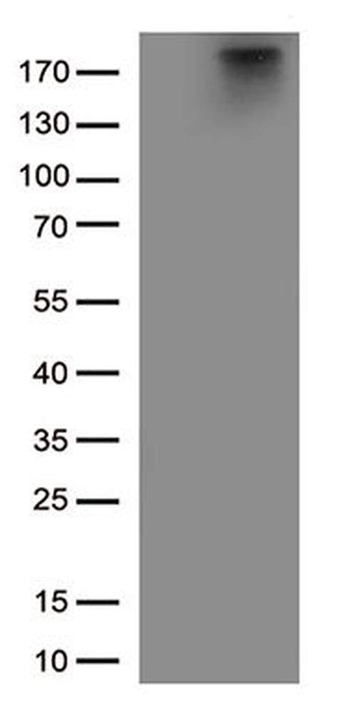 Map2 Monoclonal Antibody Oti3e2 Ta813554