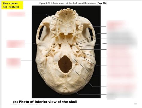 Inferior Aspect Of The Skull No Color Diagram Quizlet
