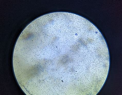 Guru Raj On Linkedin Staphylococcus Aureus Is A Gram Positive Bacterium That Appears In…