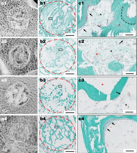 New Devitalized Freeze Dried Human Umbilical Cord Amniotic Membrane As