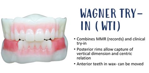 Digital Dentures And Auxiliary Knowledge Flashcards Quizlet