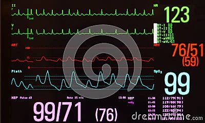 Monitor With Atrial Flutter Stock Image CartoonDealer Com 97562749
