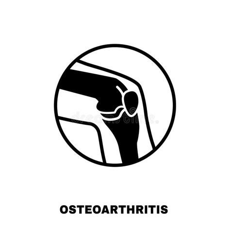Osteoarthritis Icon Image Stock Vector Illustration Of Anatomical