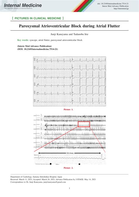 Pdf Paroxysmal Atrioventricular Block During Atrial Flutter