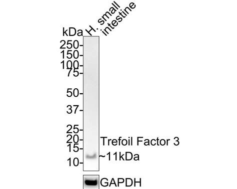 Tff3trefoil Factor 3 Recombinant Rabbit Monoclonal Antibody Je32 01