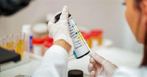 Protein In Urine Flag A At Jennifer Carranza Blog