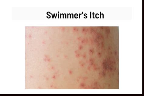 Red Spots On Skin 38 Causes Pictures And Treatment
