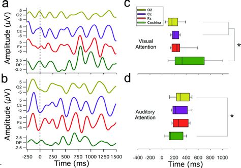 Temporal Dynamics Of Brain And Cochlear Oscillatory Activity Examples Download Scientific
