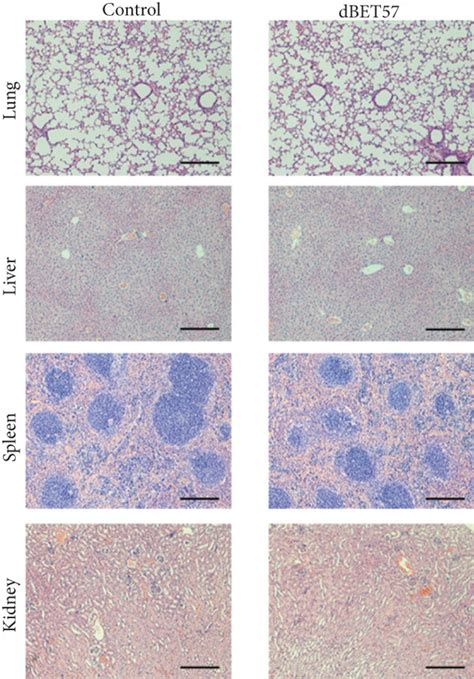 Dbet57 Exhibits Tumor Growth Inhibition Effect In Xenograft Tumor Download Scientific Diagram