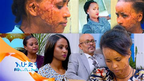 አዲስ ምዕራፍ “ከአንቺስ የሞቱት ይሻላሉ ይሉኛል” እሁድን በኢቢኤስ Youtube